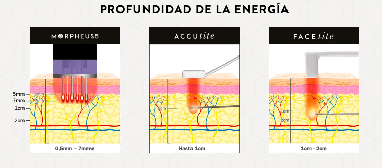 Embrace RF - Técnica de Rejuvenecimiento facial | DEX Cirugía Plástica